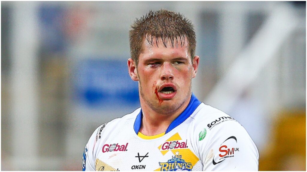 Why Leeds Rhinos man Tom Holroyd has been given TEN-MATCH ban - Serious ...